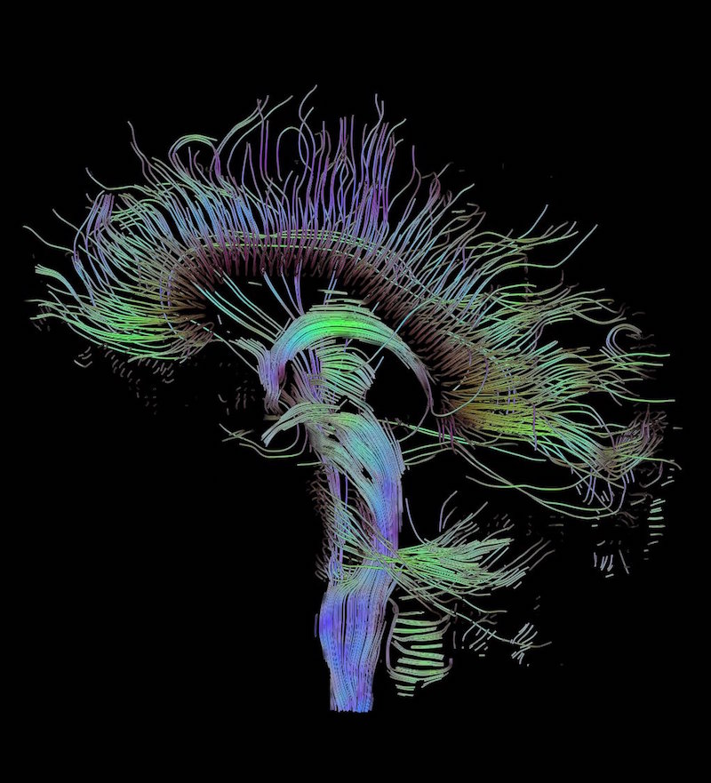 Neuroarchitecture: Thinking with Our Buildings | BuildingGreen